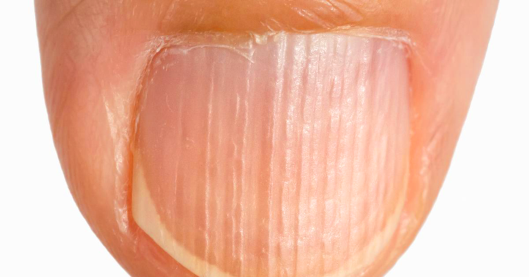 8 signs that you might have a protein deficiency - Bestoknow